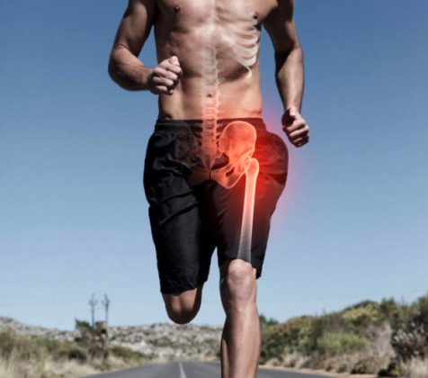 A Comprehensive Guide to Recovering from Osteitis Pubis - Runner's Tribe